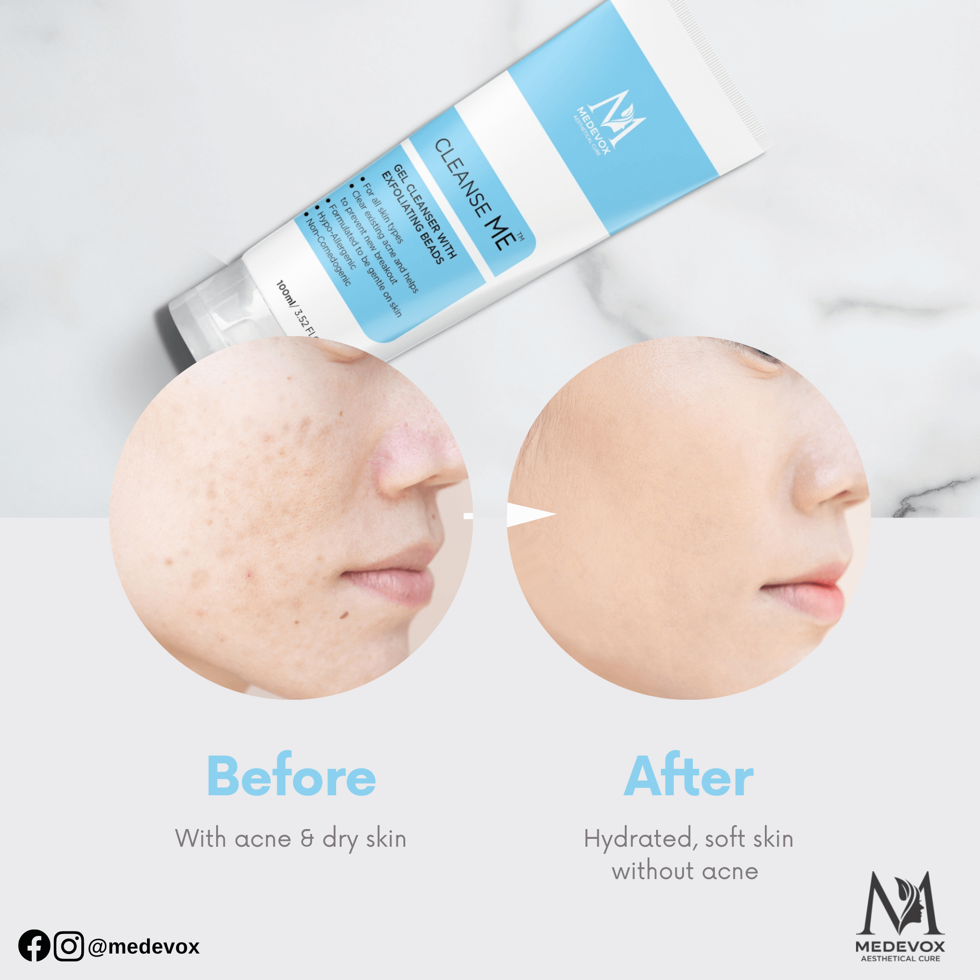 CLEANSE ME | Facial Cleanser - Medevox Aesthethics