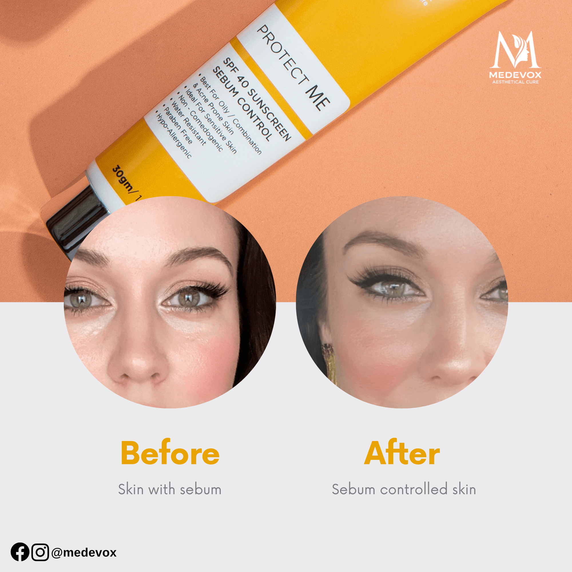 Protect ME: Spf 40 | Sebum Control | Best For Oily & Sensitive Skin Pr ...